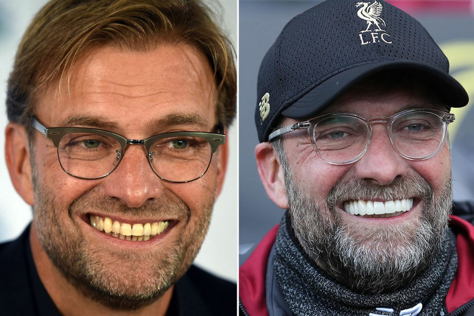 Klopp’s Teeth vs Firmino’s Teeth - Eye-Catching EPL Rivalry
